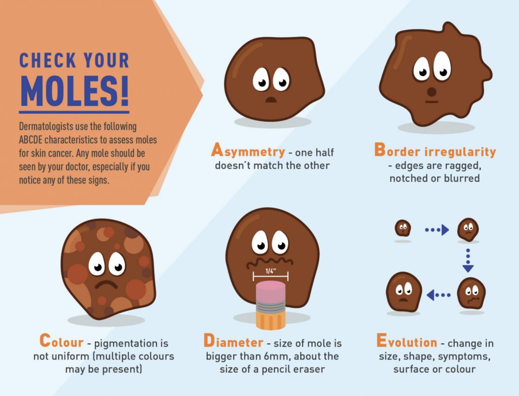 Skin cancer - Mudgeeraba Family Medical Centre